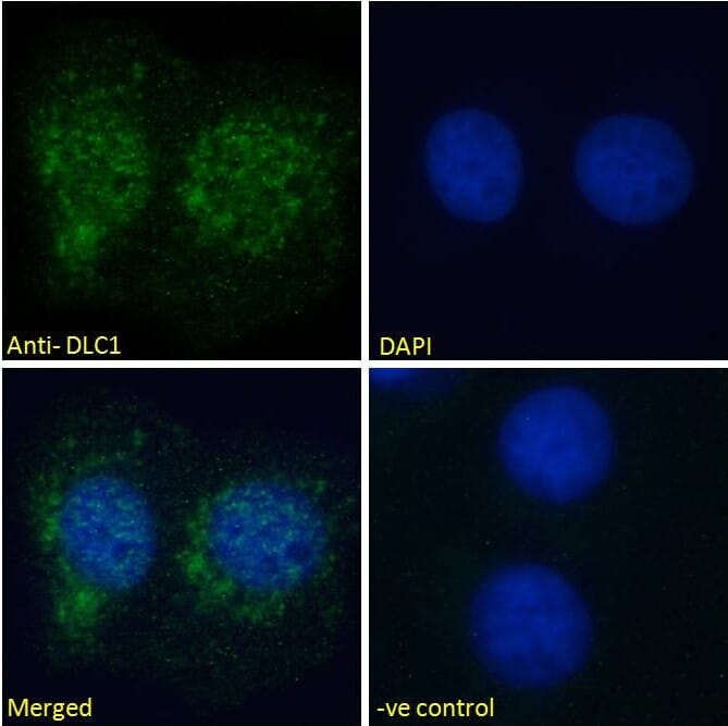 Anti-DLC1 Antibody (A83189) | Antibodies.com