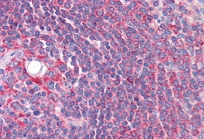 Anti-CYP26B1 Antibody (A84266) | Antibodies.com