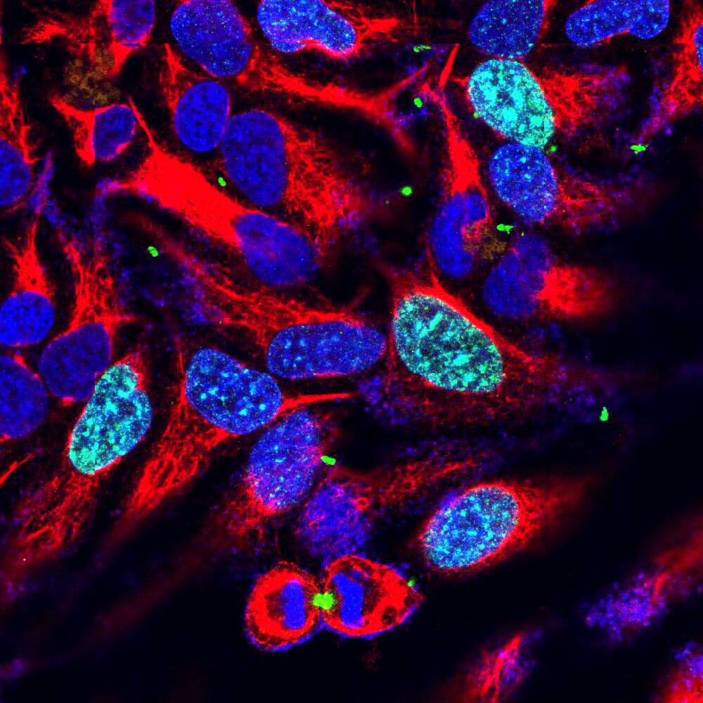Anti-Aurora B Kinase Antibody (A85381) | Antibodies.com Anti-Aurora B Kinase Antibody (A85381) | Antibodies.com