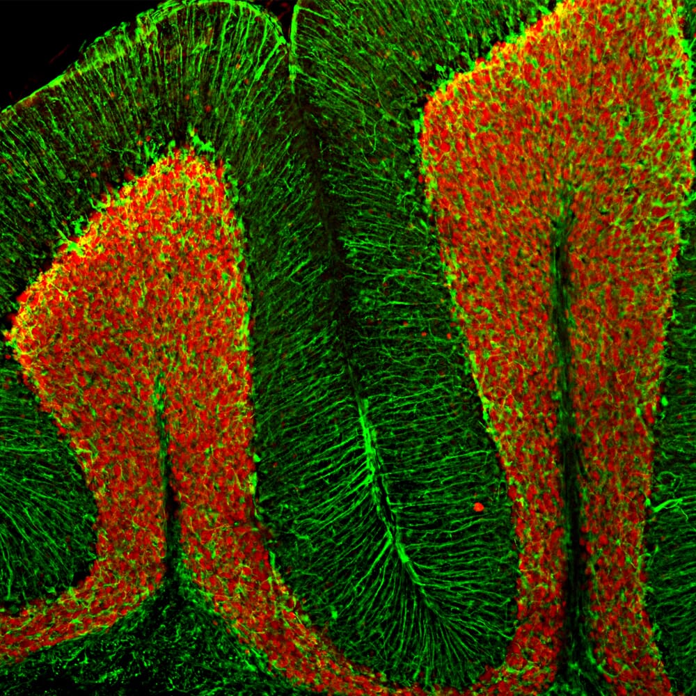 Secondary Antibodies | Antibodies.com