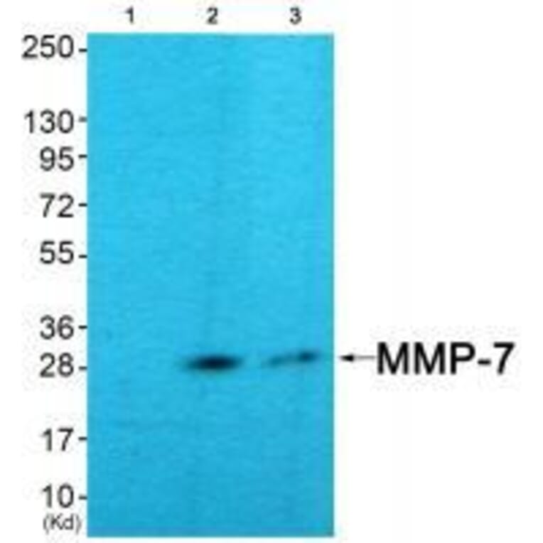 Anti-MMP-7 Antibody (A37693) | Antibodies.com
