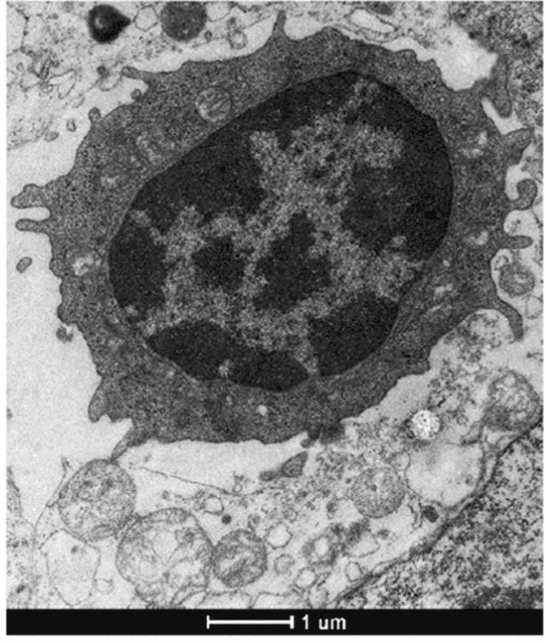 Natural Killer Cell Markers | Antibodies.com